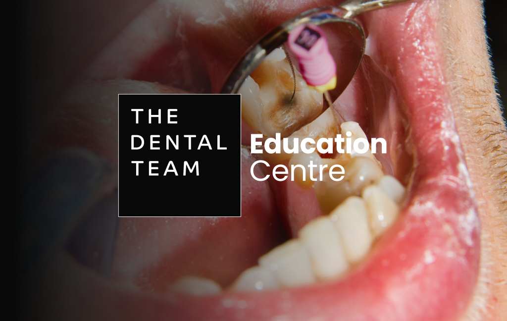 Join our upcoming Basics of Root Canal Treatment Endodontics Course
